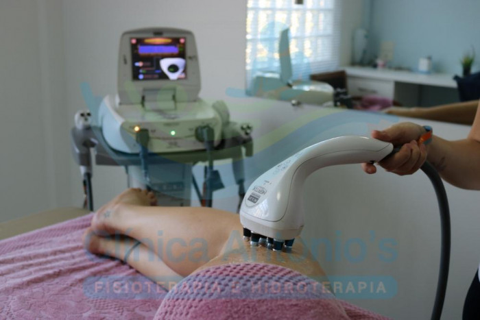 Radiofrequência - Clínica Antonio's